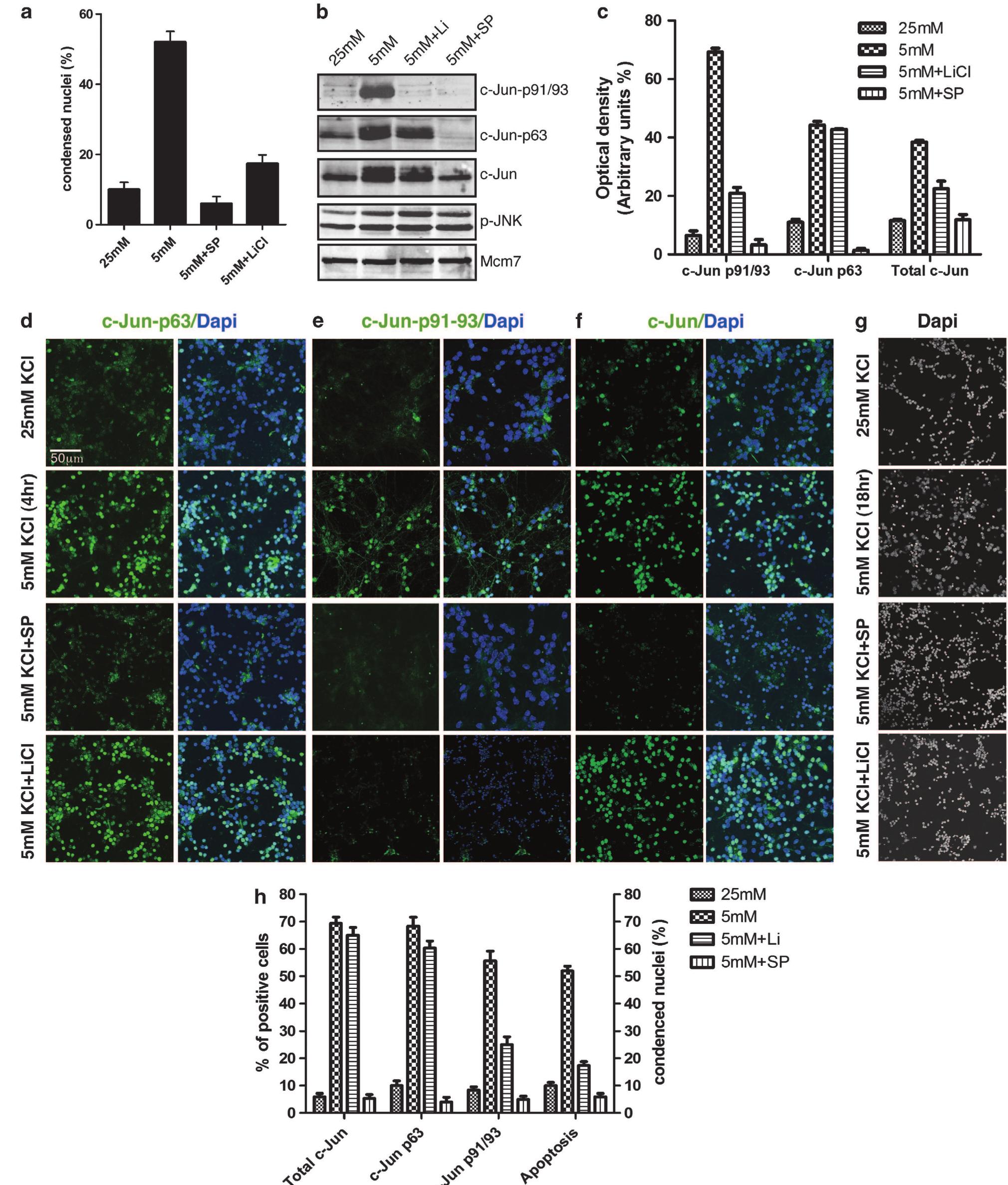 Cultures were tk-deprived for 18h and analyzed for condensed