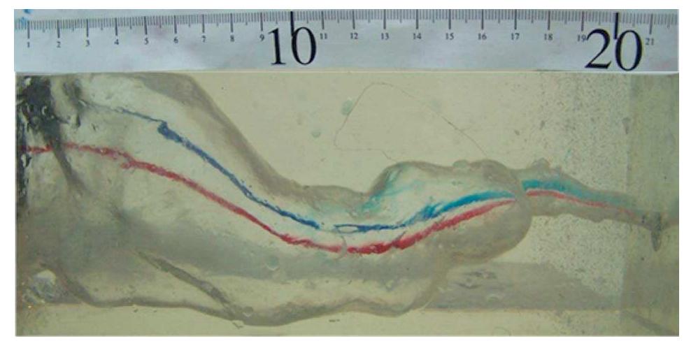 Flow visualization in 3d realistic cystic duct model: pa-