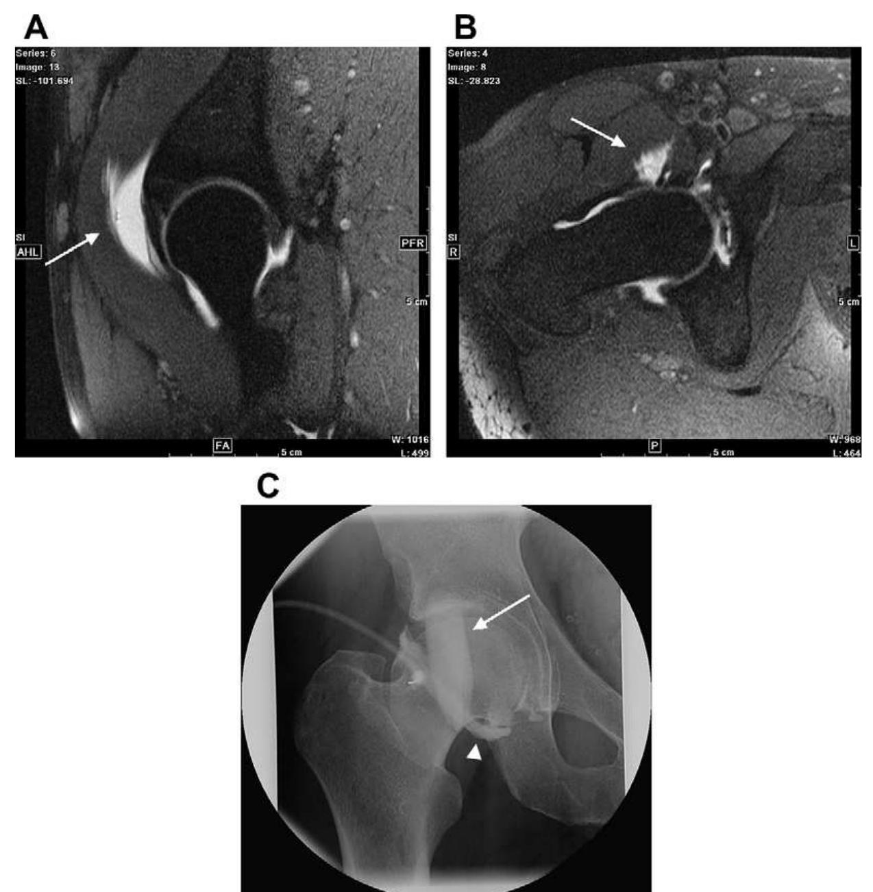 Sagittal (a) and axial (b) t1 fat-suppressed images from a