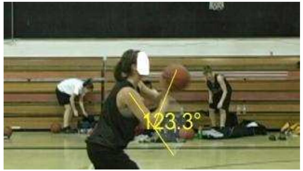 Measurement of elbow joint angle range of motion (rom) at