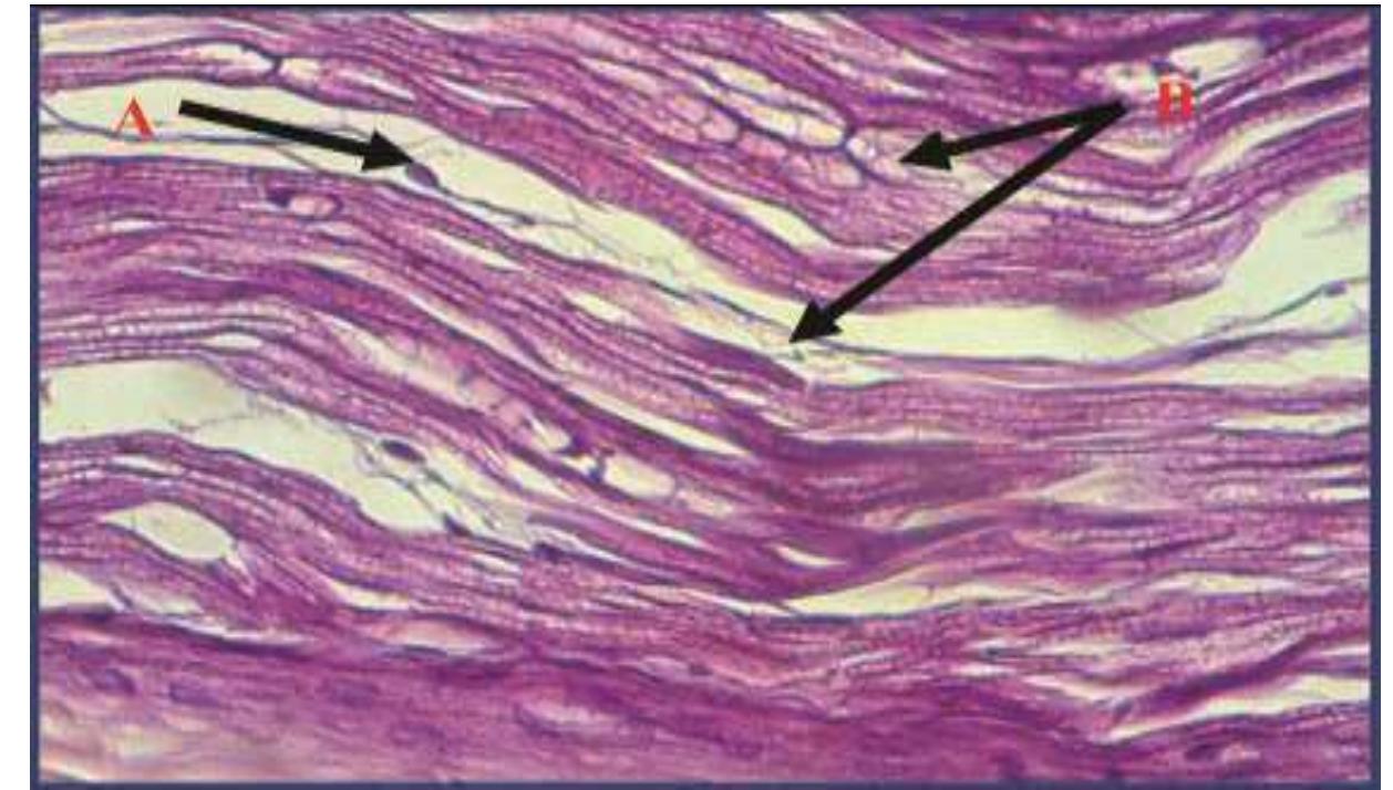 -7: the distal longitudinal section of sciatic nerve of