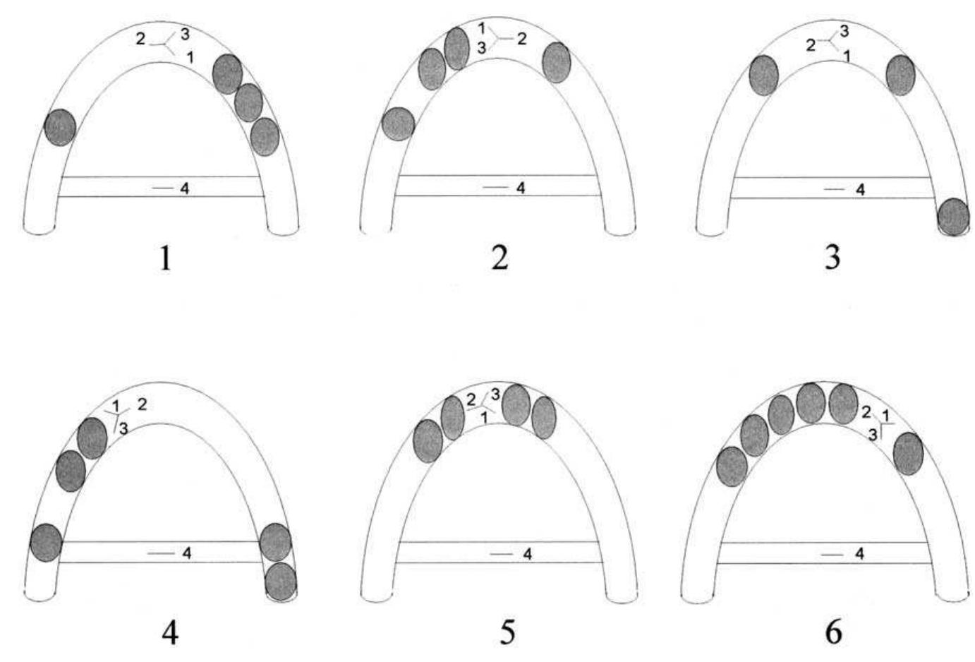 Position of strain gages in tested conical crown retained