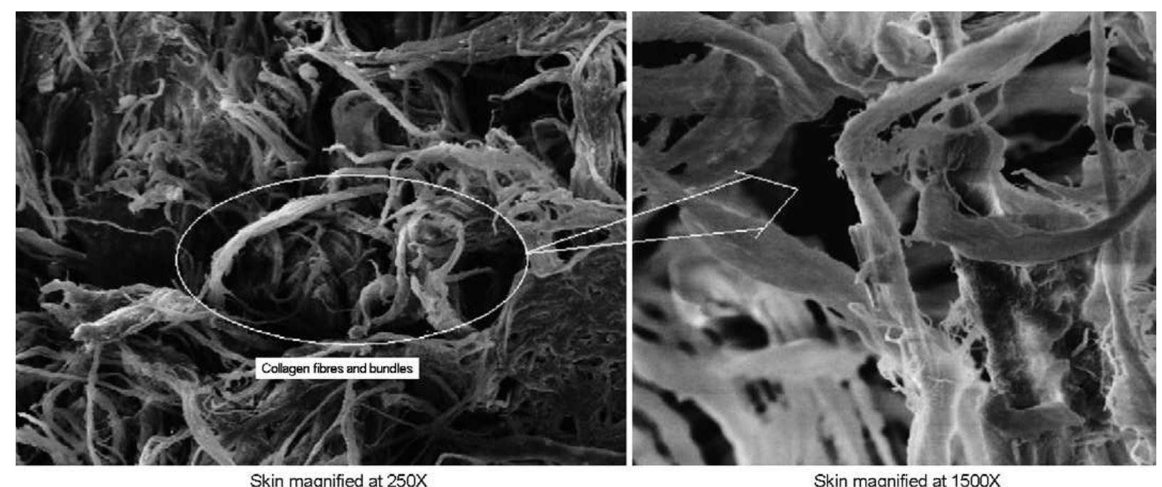 Sodium chloride (control salt) treated skin scanning