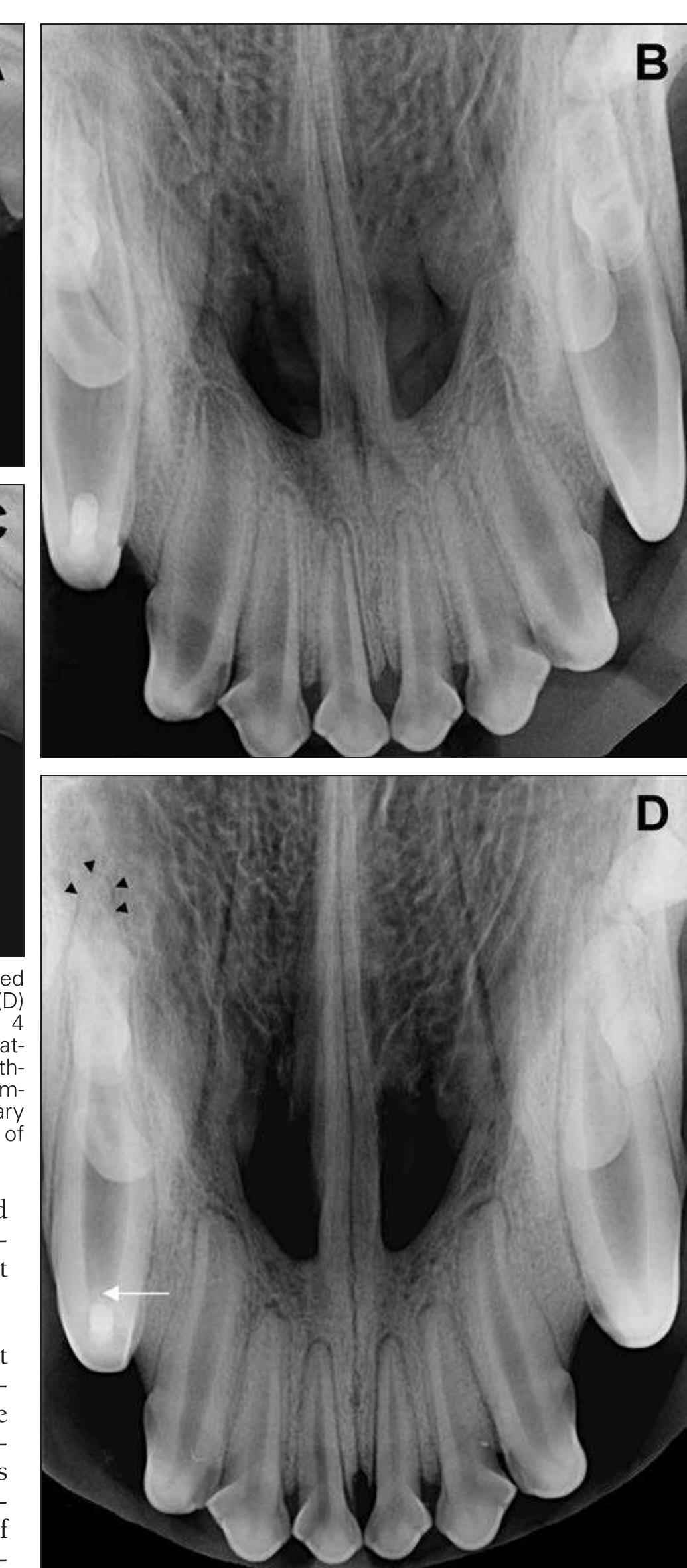 Figure 1 - Vital pulp therapy in dogs: 190 cases (2001-2011