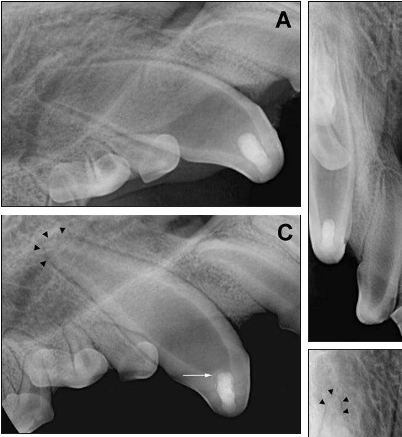 —lateral (a) and occlusal (b) radiographic views obtained