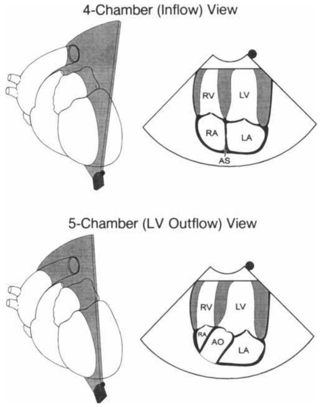 Fic. 5. left caudal (apical) parasternal location,