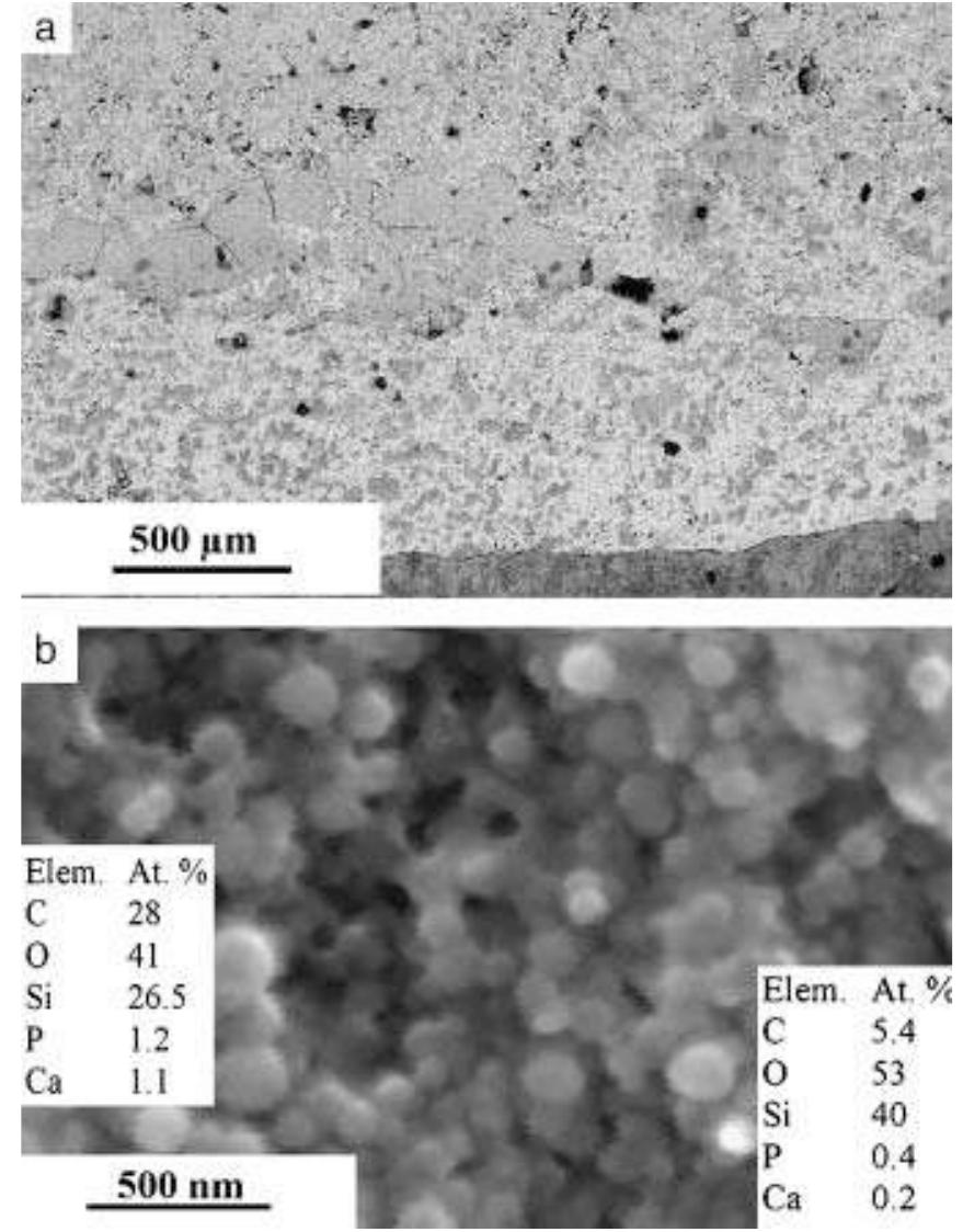 Backscattered scanning electron microscopy micrographs of