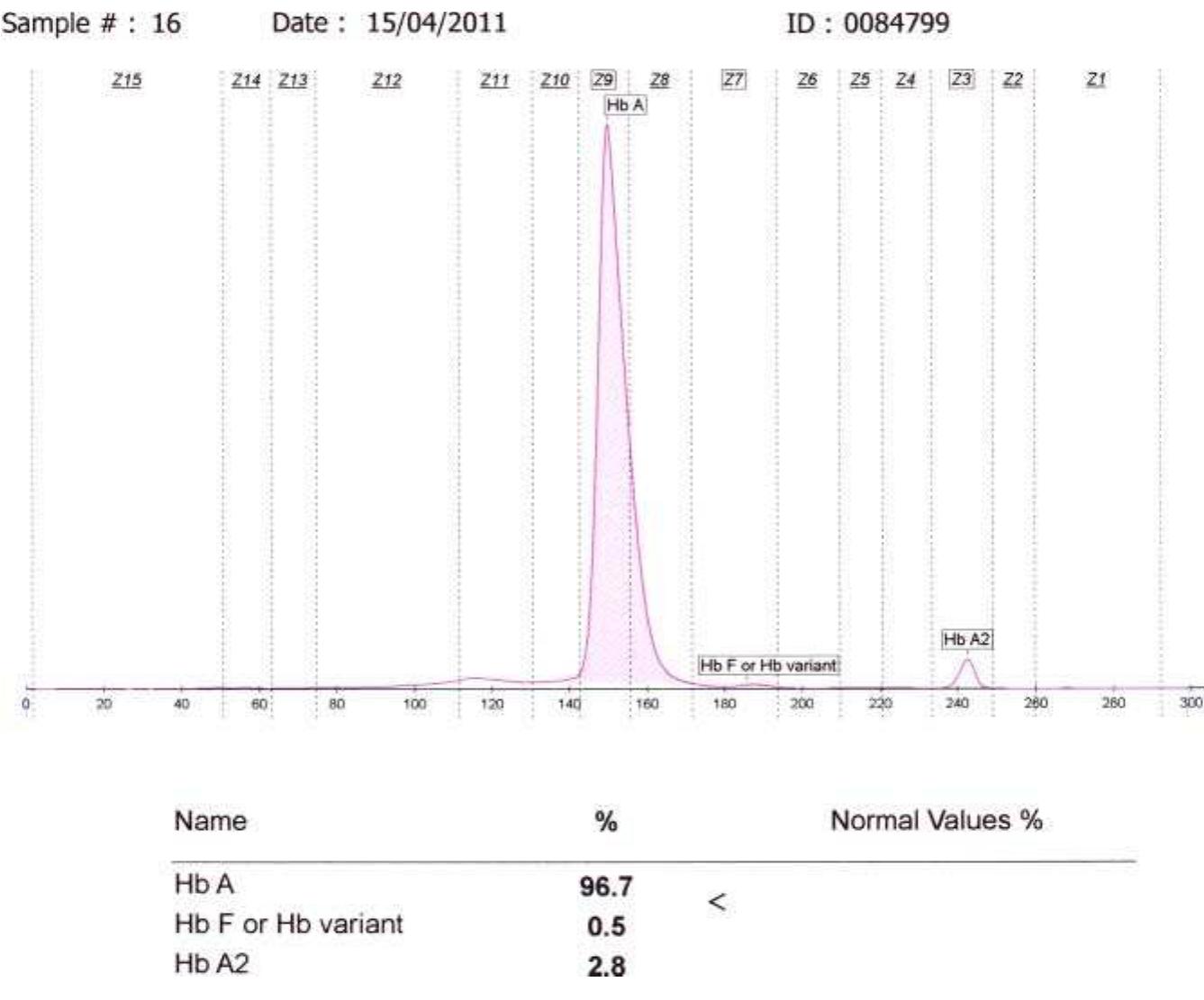 Figure 1 - from Capillary zone electrophoresis for