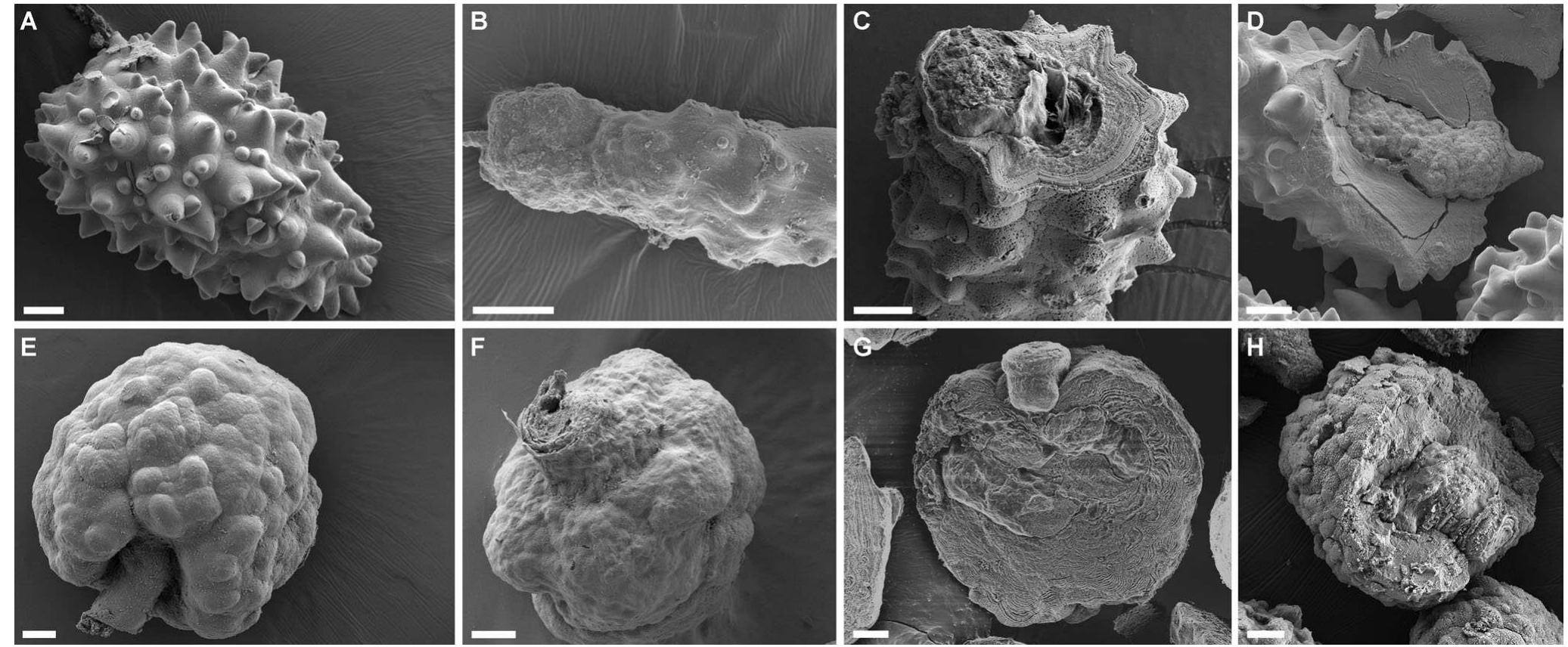 (PDF) Plant Cystoliths: A Complex Functional Biocomposite of Four ...