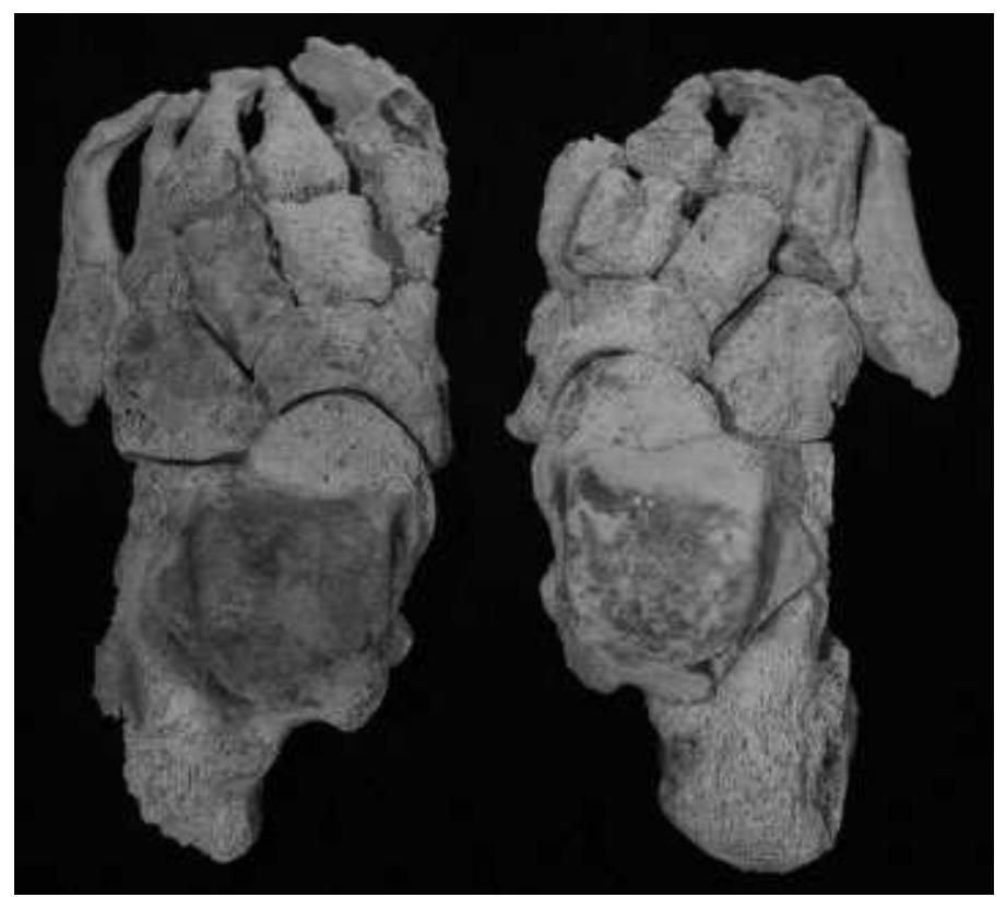 Left and right foot from individual in zone 9a, tomb