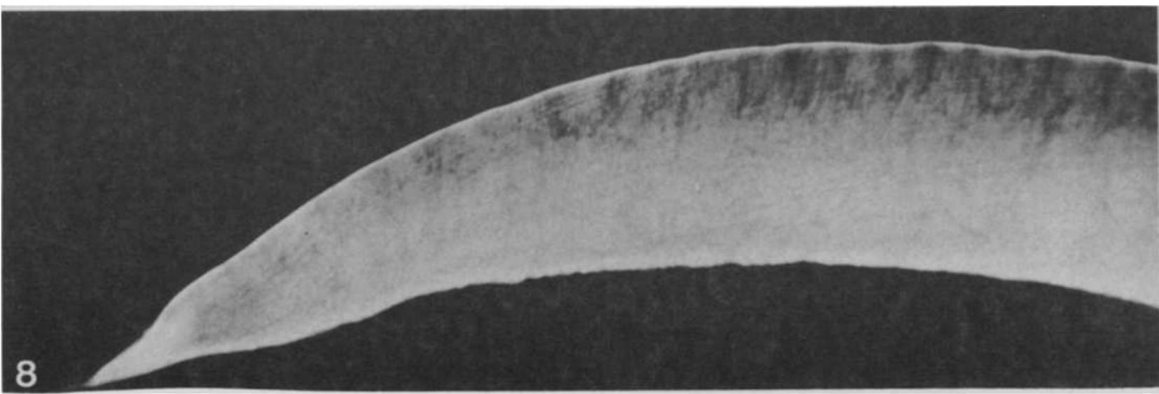 Microradiograph of buccal enamel from a severely fluorosed
