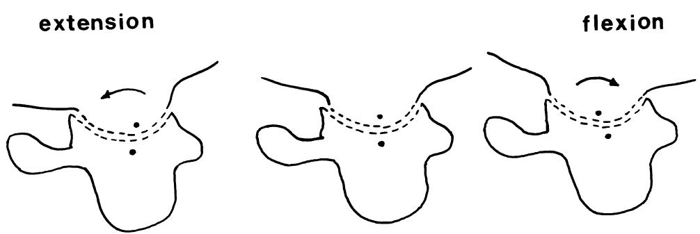 Right lateral views of flexion and extension of the