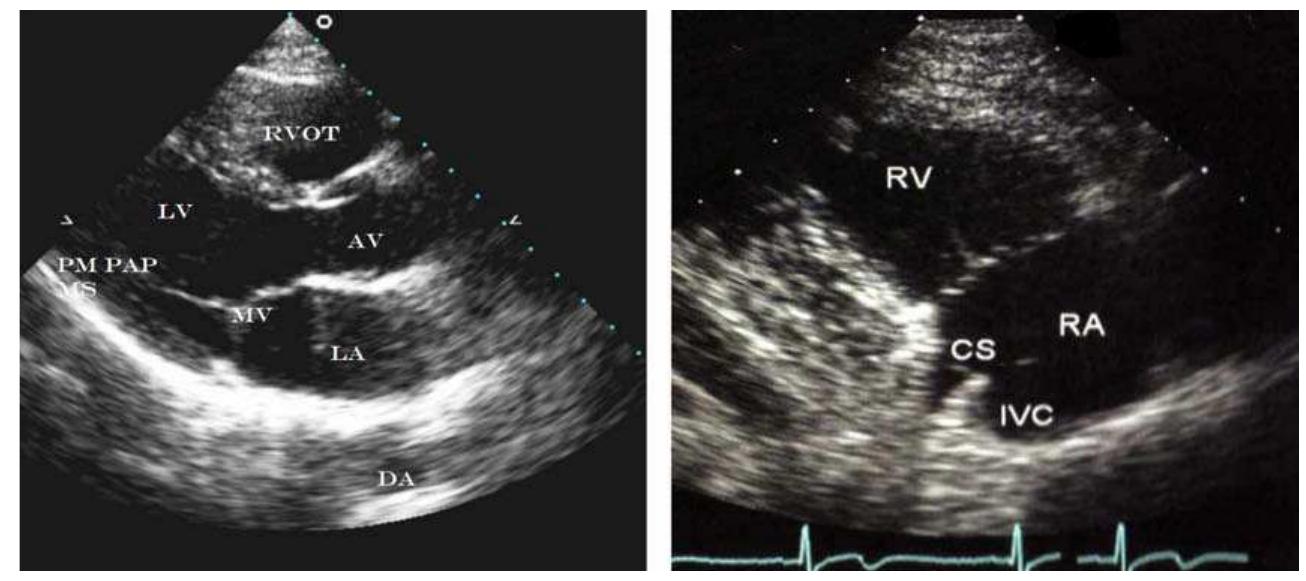 A detailed transthoracic echocardiographic examination in-