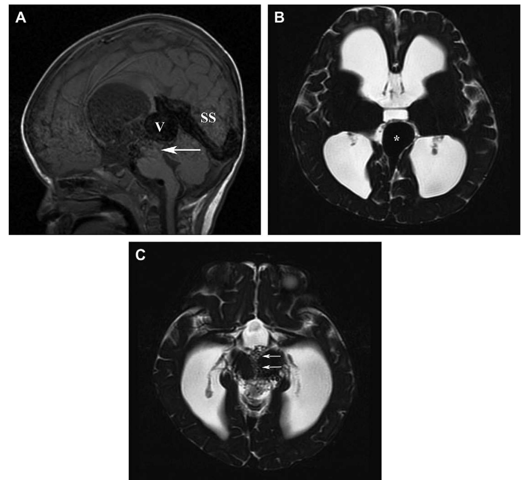 (a) midline sagittal t1-weighted magnetic resonance imaging