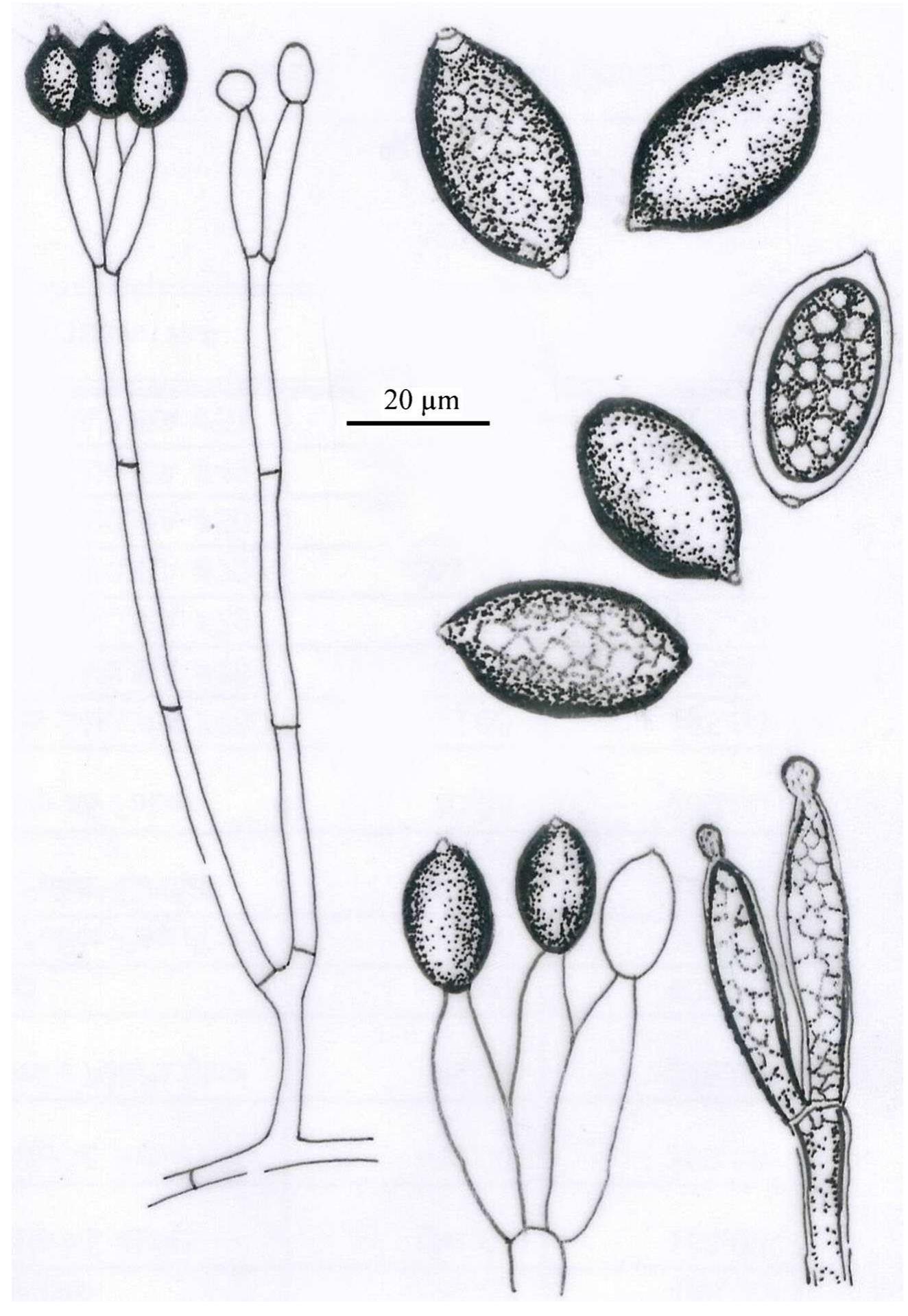 Figure 45 - Overview of Stachybotrys (Memnoniella) and