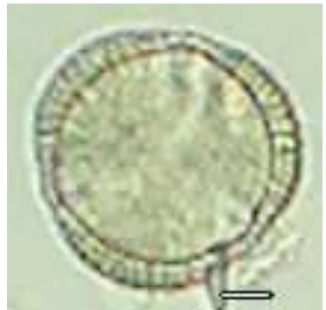 Figure 41 - Pollen Identification using morphological