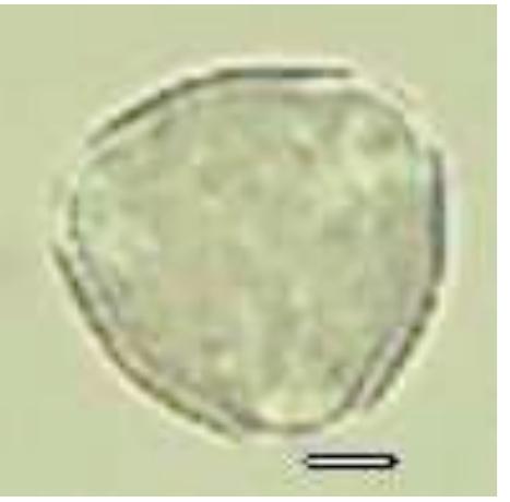 Figure 49 - Pollen Identification using morphological