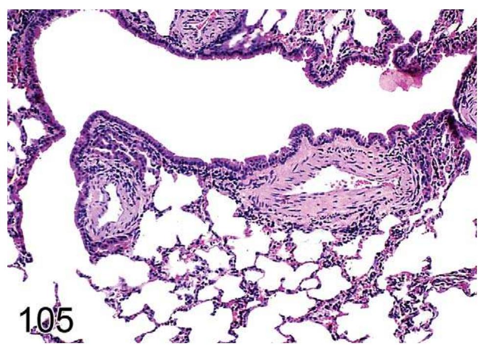 Ficure 105.—mouse. lung, medial hypertrophy of pulmonary