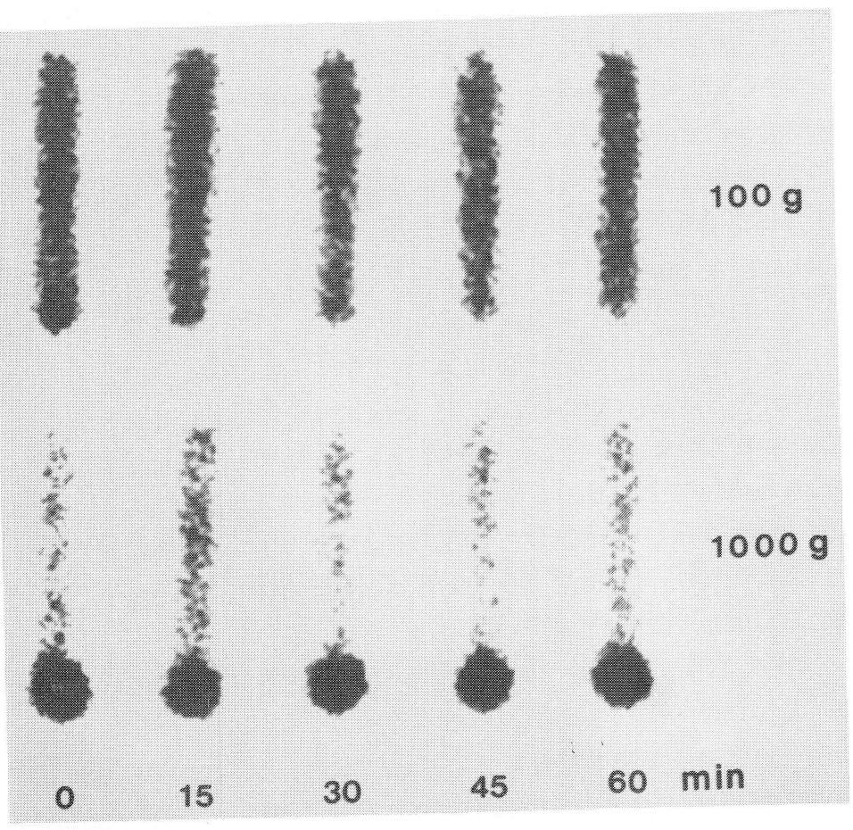 Pena the labeled cell purity of plasma washed leukocyte