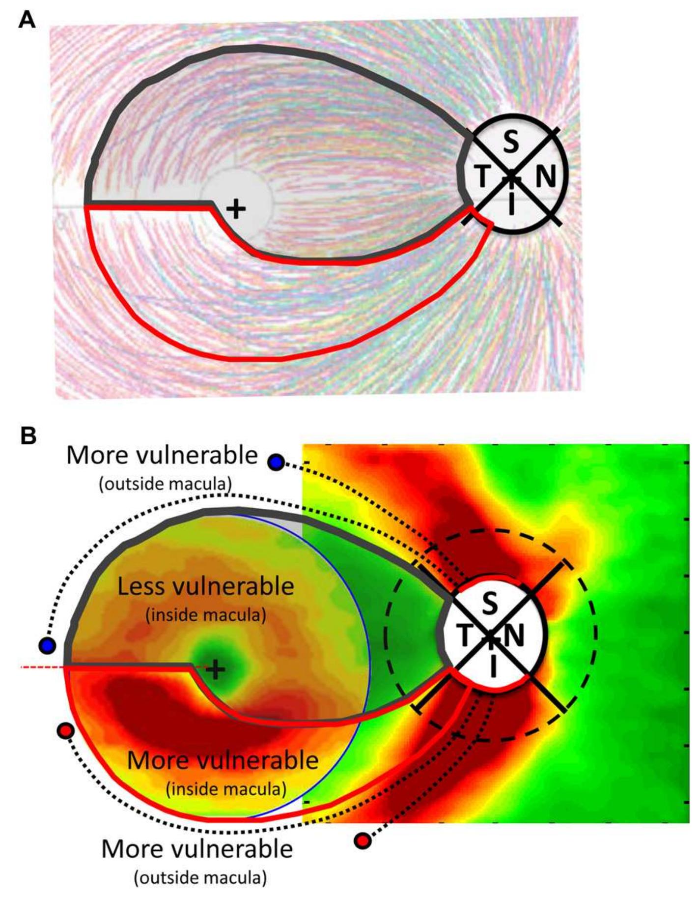 A schematic model of rnfl projections and glaucomatous rgc+