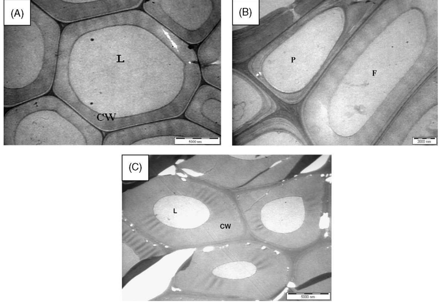 Transmission electron micrograph of ultra-thin section of