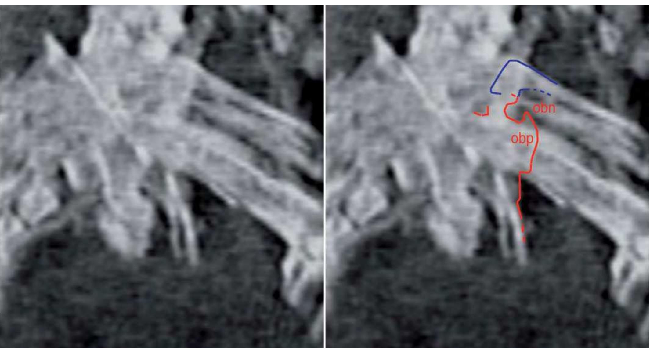 - computed tomography of the pelvic region of scipionyx
