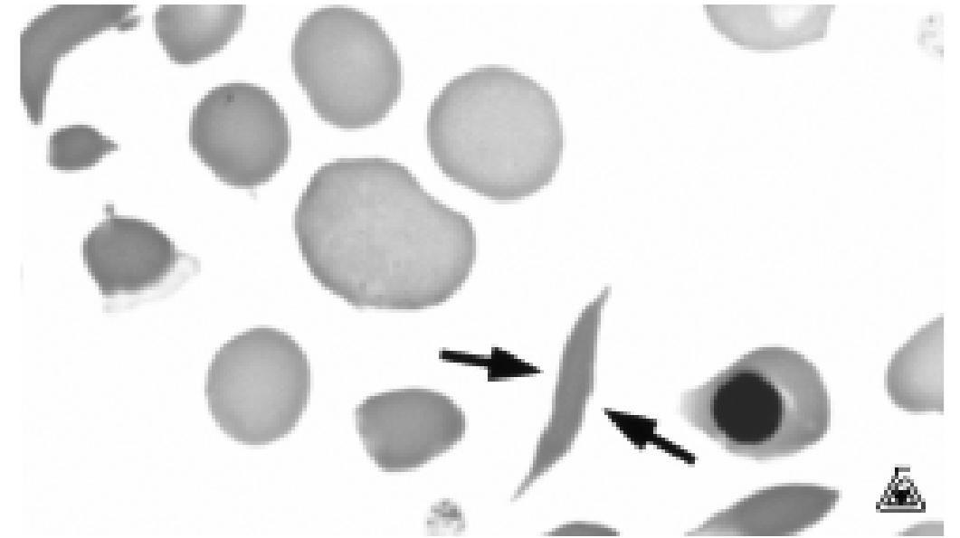 Precursors, suggestive of reticulocytes, are released from