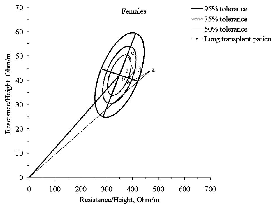Bioelectrical impedance vector analysis (biva) with the rxc