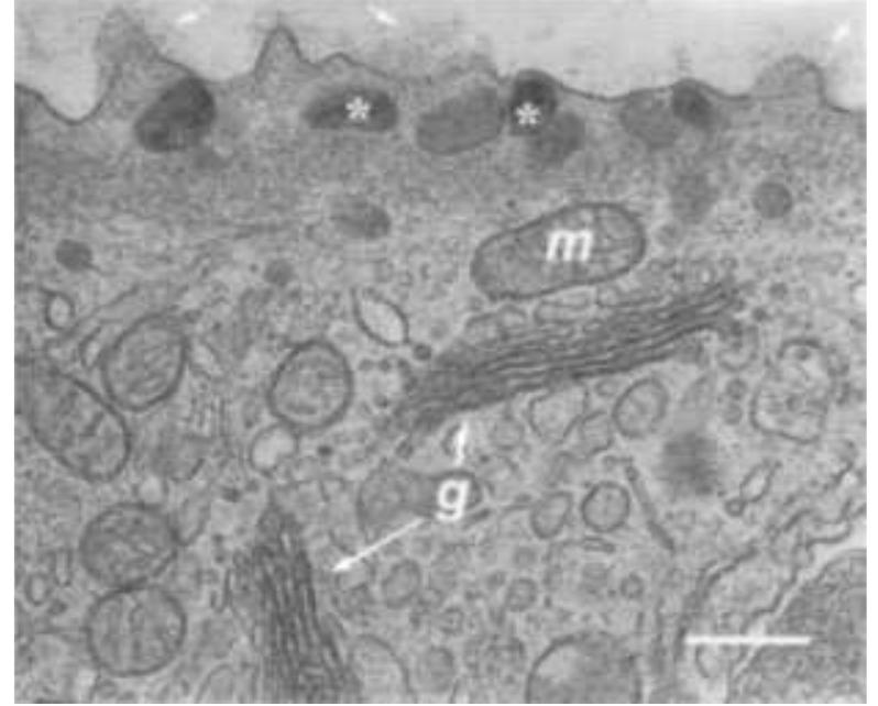 Tem of the apical region of a pavement cell from the dogfish