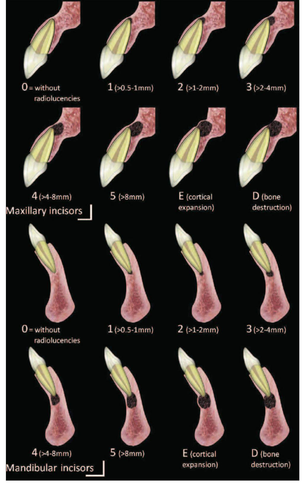 Schematic representation of incisors cbctpai. table 2 shows