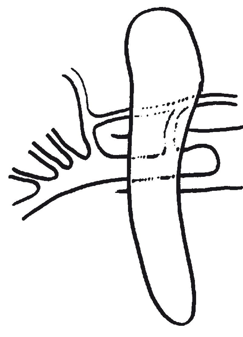 Figure 32 - from Damage Control Management in the Polytrauma