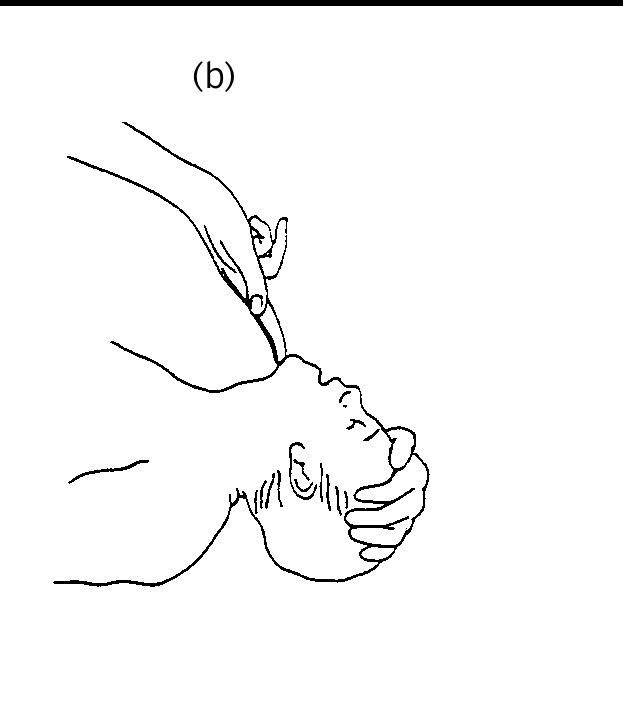 1 (a) head tilt and chin lift (adult); (b) head tilt and