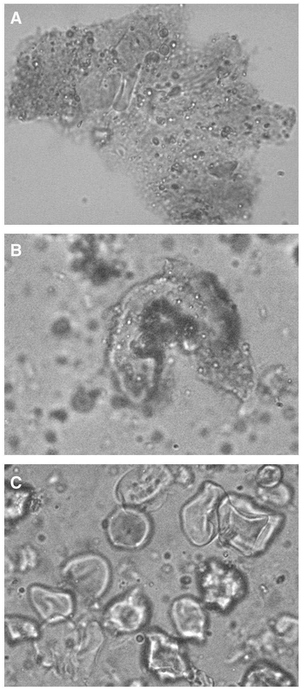 A) microscopic structure of extruded corn at the water flow