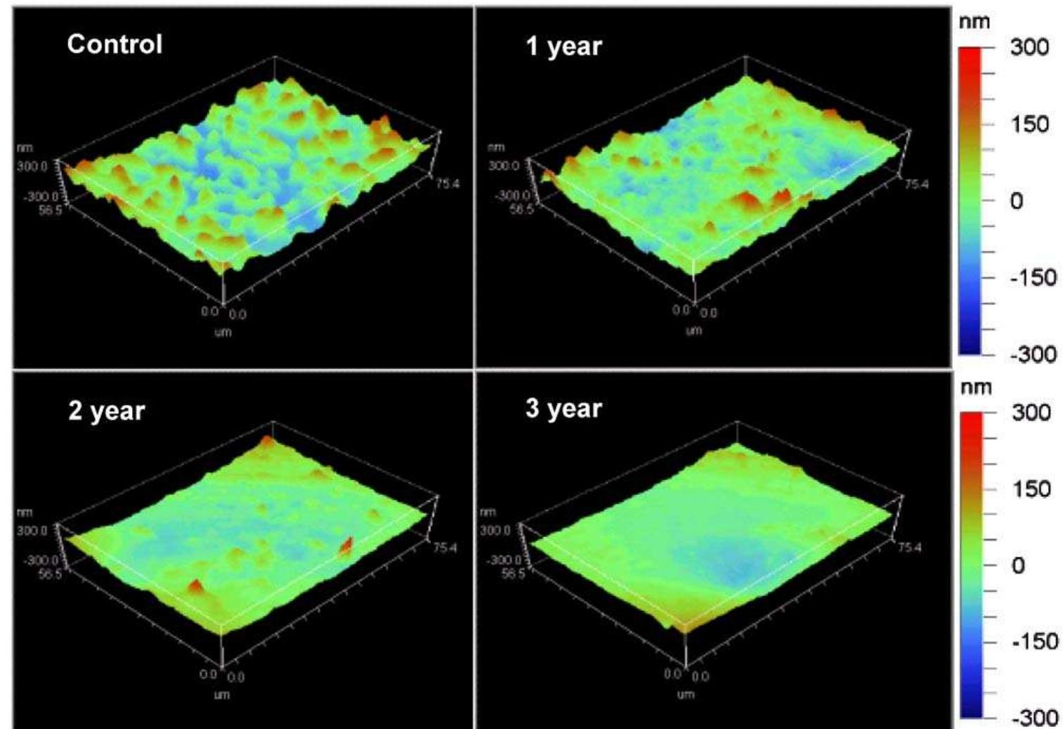 3d plots of typical articular surfaces from region | of the