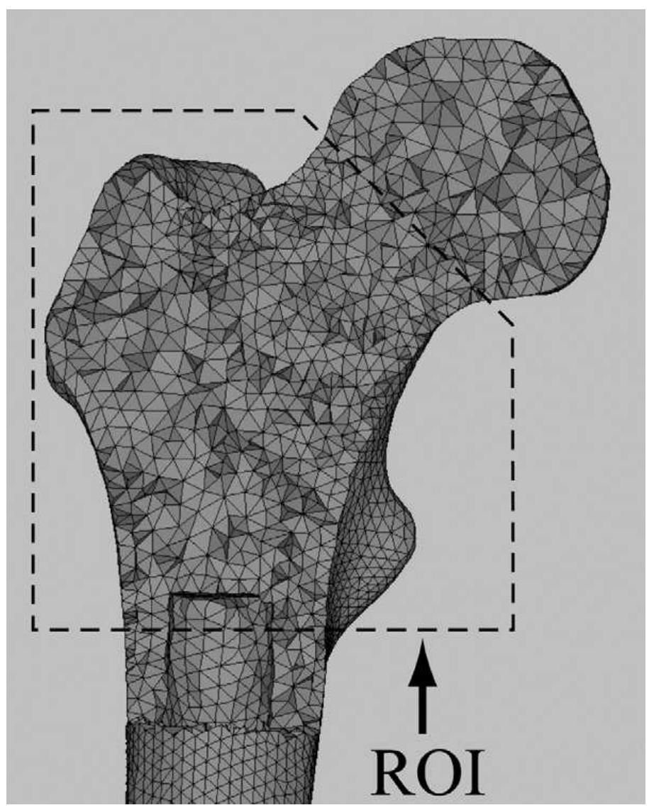 A Detail Of The Proximal Femur Finite Element Model