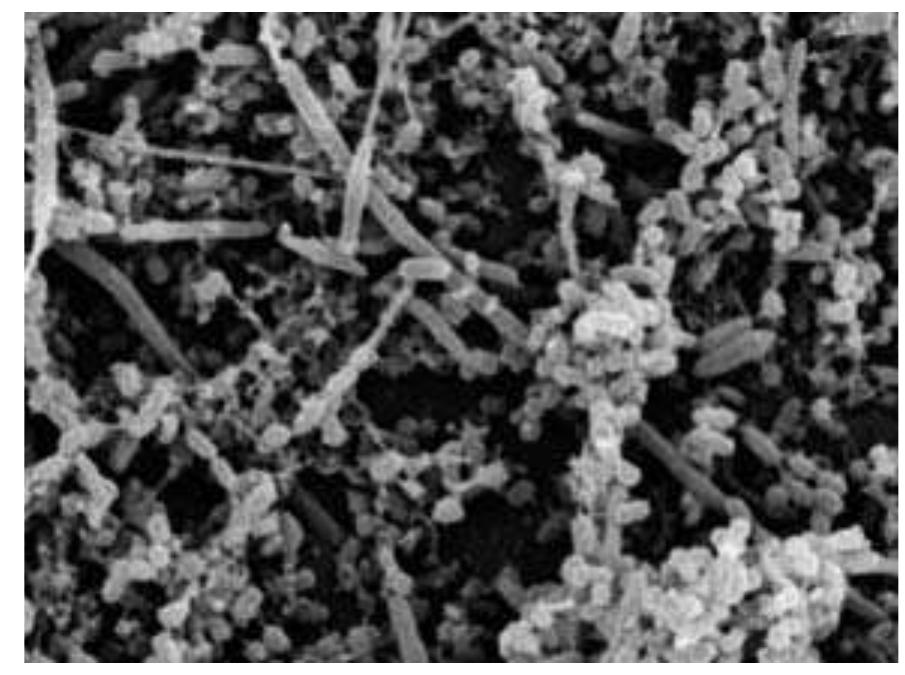 Scanning electron micrograph of the infected root canal of a