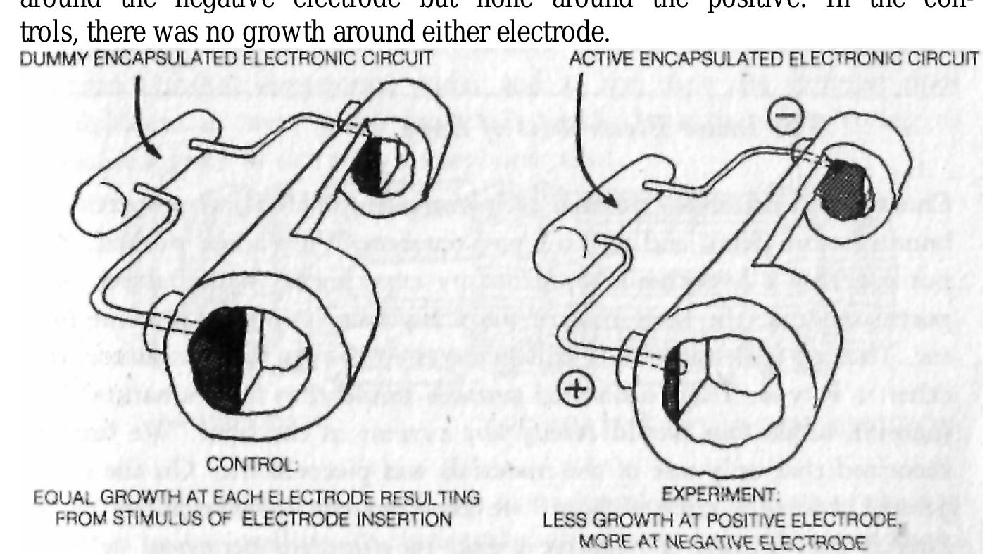 Electrical stimulation of bone growth >