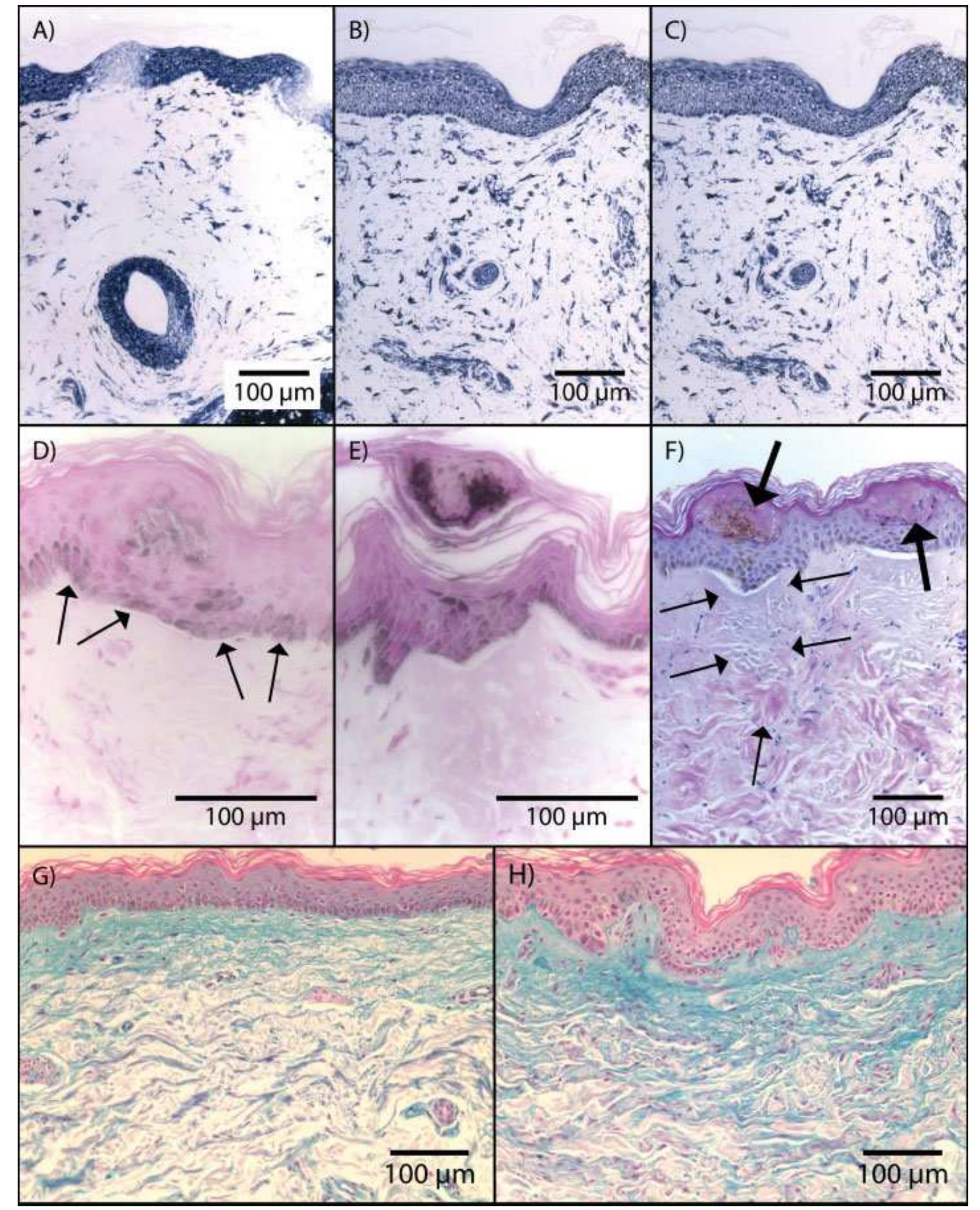 F: h&e stain depicts microanatomy of the mtz at 1 day post