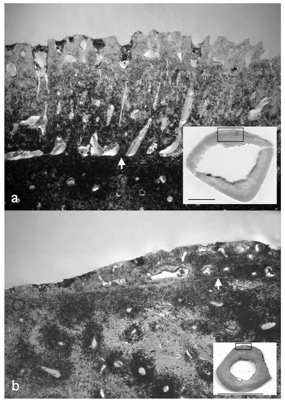 Histological cross section of (a) tibial diaphysis of burial