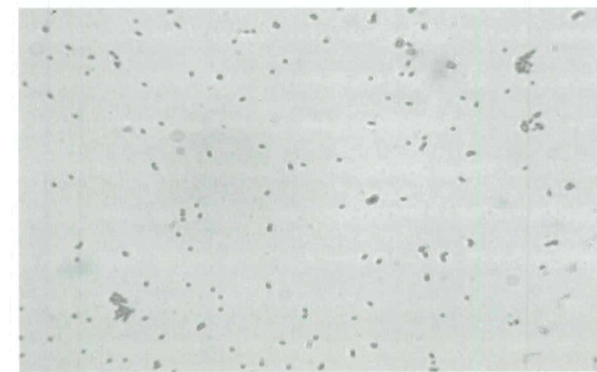 Compound light microscope image of cocci after gram stained.