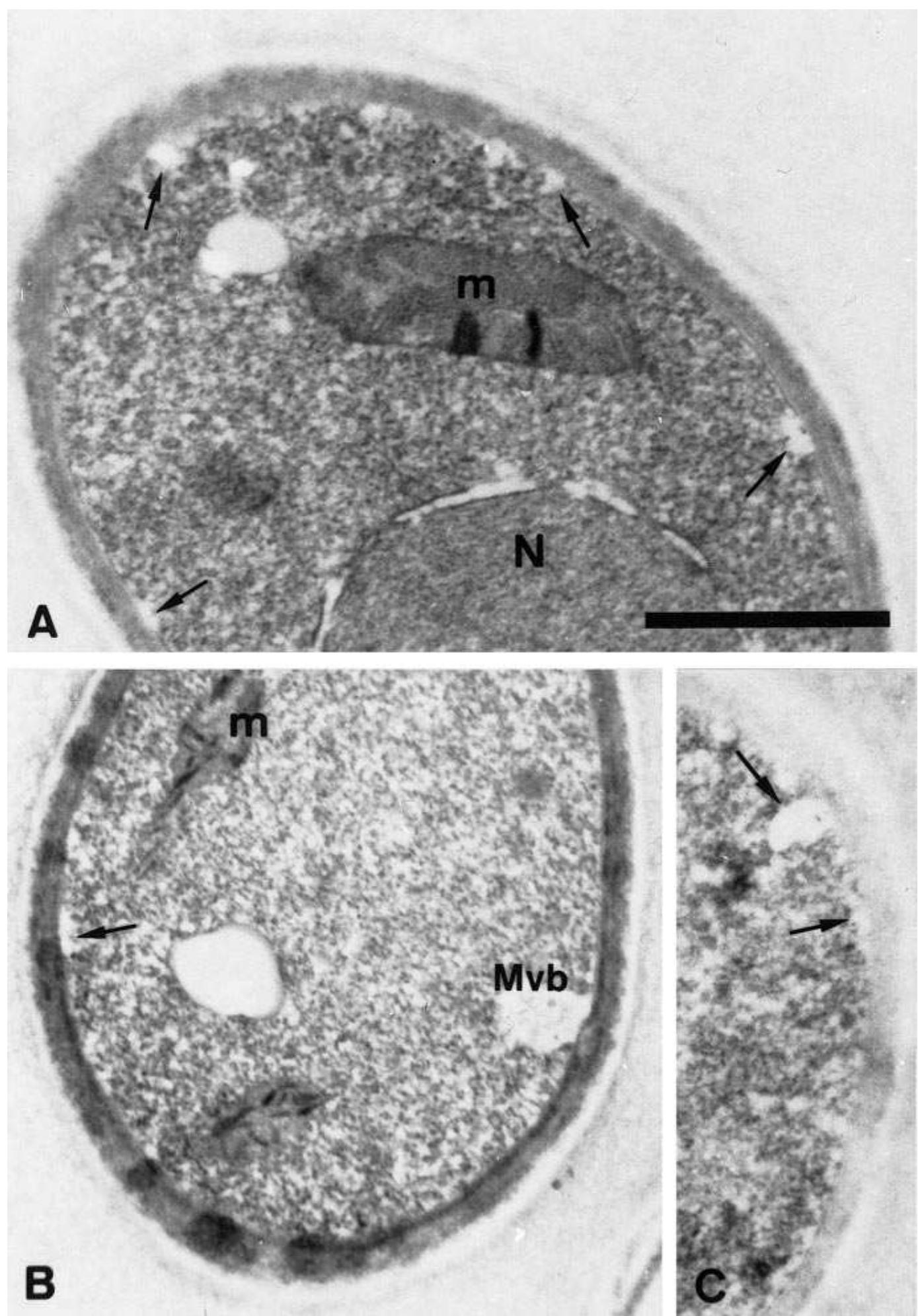 Transmission electron micrographs showing the substrate