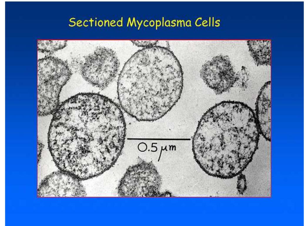 Electron micrograph of thin-sectioned mycoplasma cells. the