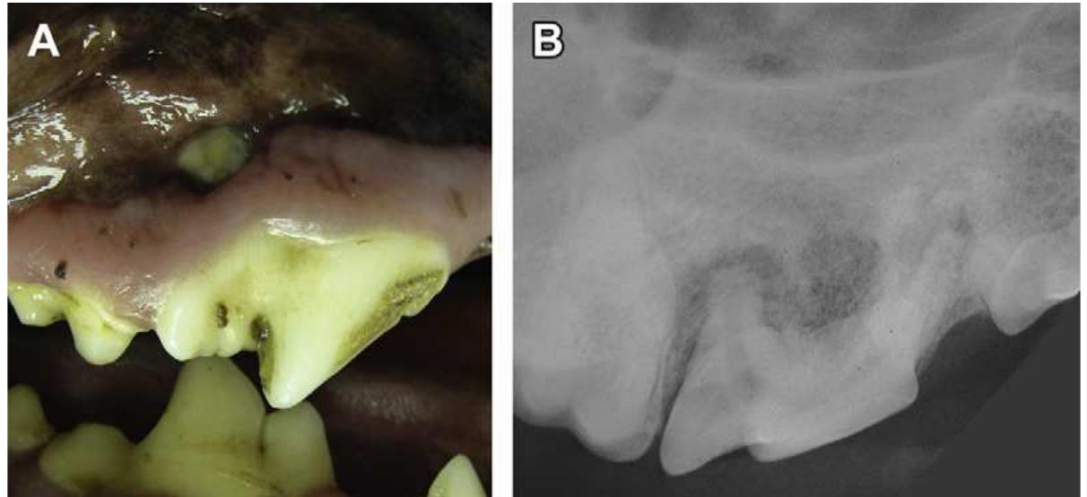 (a) clinical appearance of the right maxillary fourth