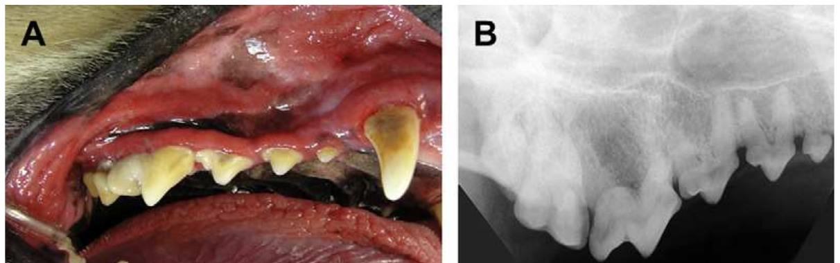 (a) ulcerative stomatitis featuring gingivitis, buccal