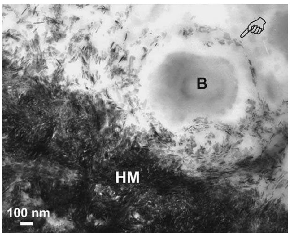 (a) undemineralised tem micrograph of a bacterium (b) within