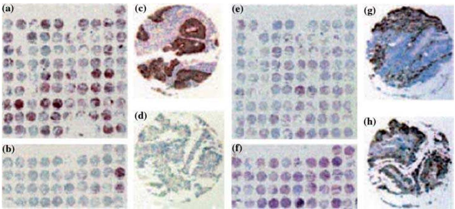 Staining with human anti-villin (a_d) and moesin (e_h)