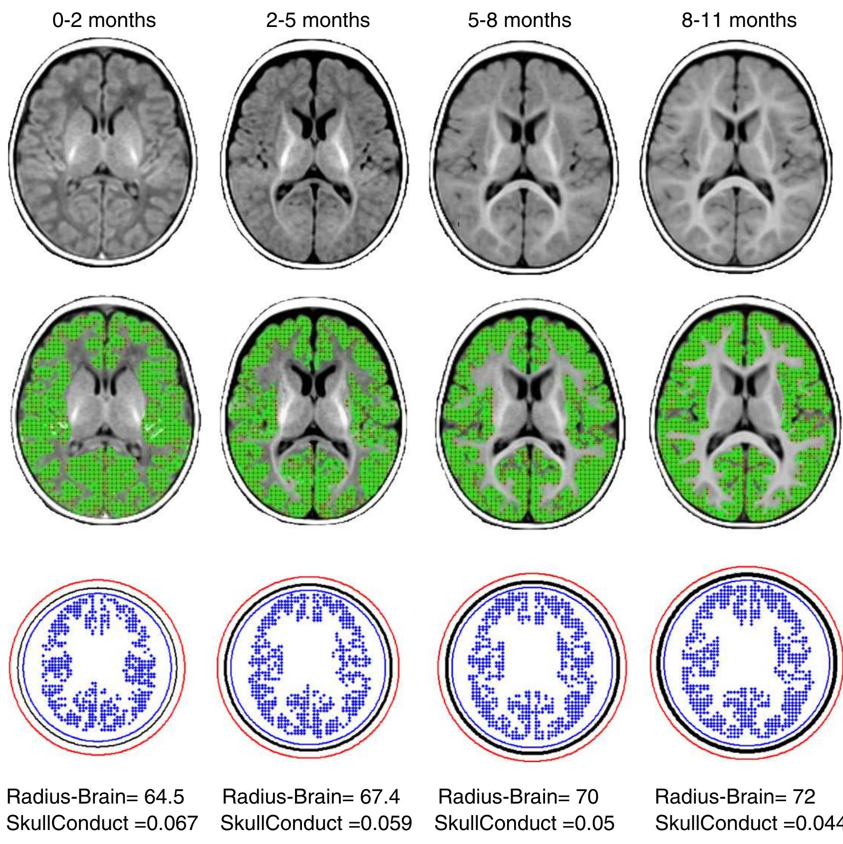 Neonates brain templates. representative slices of the mni