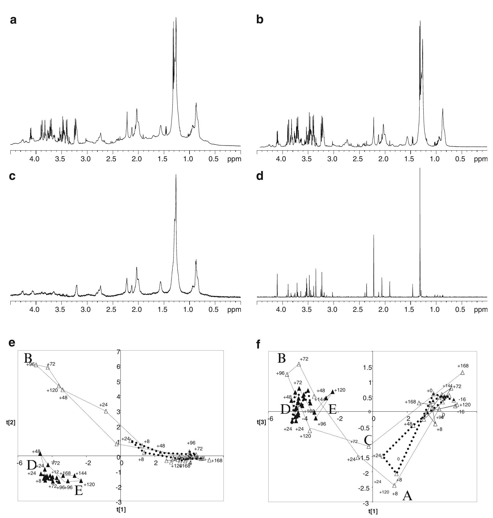 3 (a) standard one-dimensional 'h nmr spectrum of human