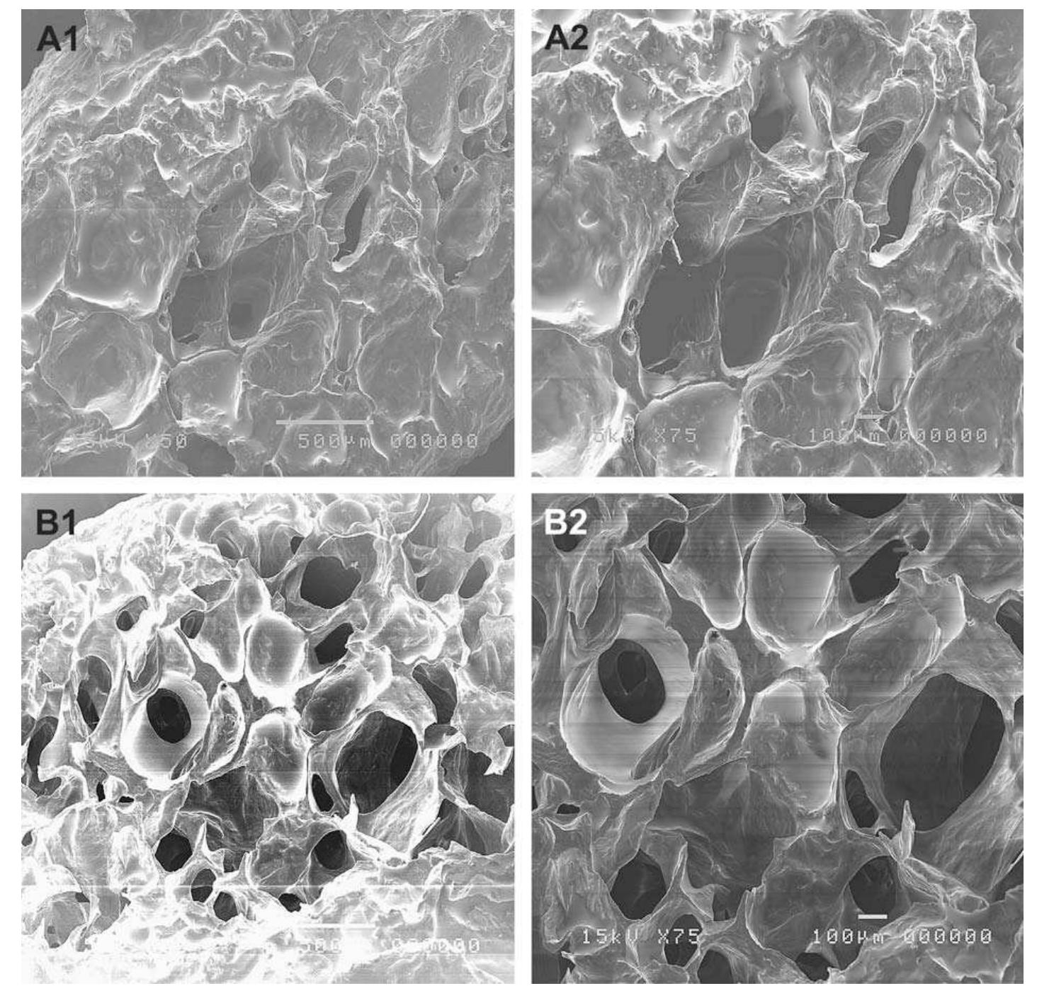 Electron microscope photograph of control (a1 and a2) and