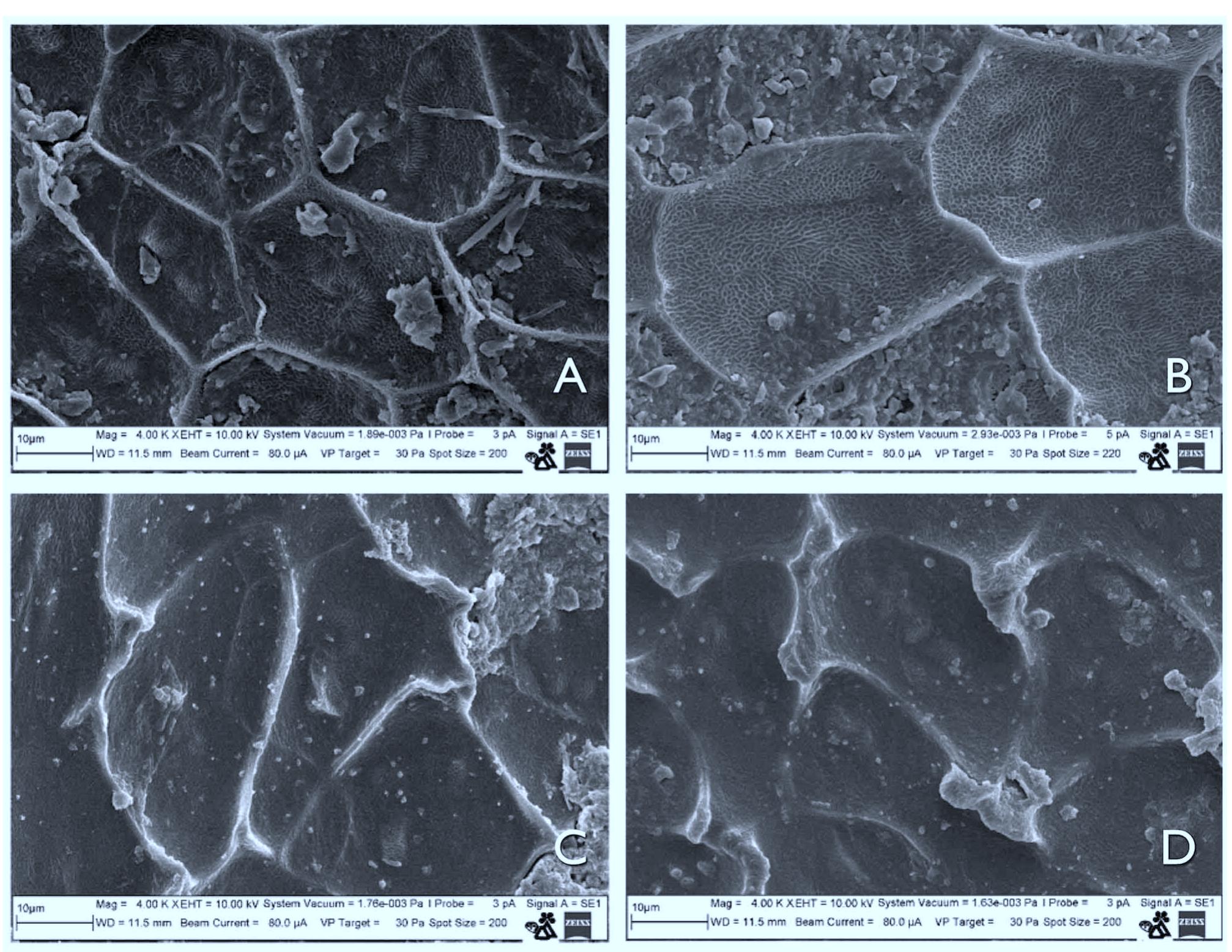 Dorsal scale microdermatoglyphic pattern of a. matildae